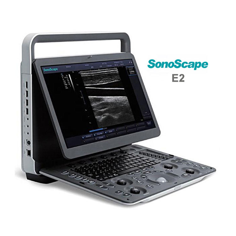 Medsinglong Portable 3D 4D 5D Ultrasound Scanner for MSK, OB/GYN, and ...
