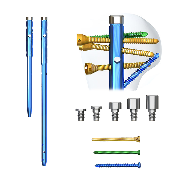 Trauma Orthopedic Implants Interlocking Titanium Nail Multi-Lock ...