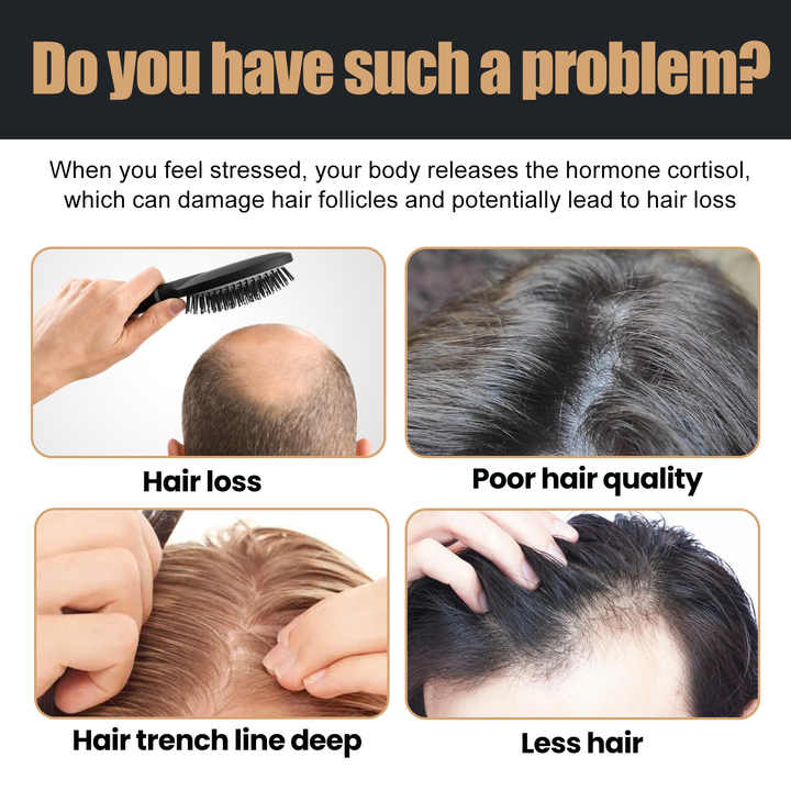 Wholesale Private Label 100ml Root Activating Anti Hair Loss Shampoos ...
