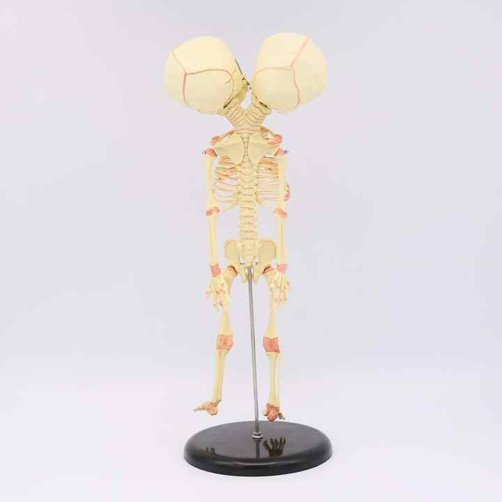 Kyrenmed Double Head Baby Anatomy Model for Medical Study
