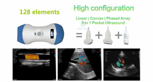 Wireless Ultrasound Probes - Portable & Powerful Solutions