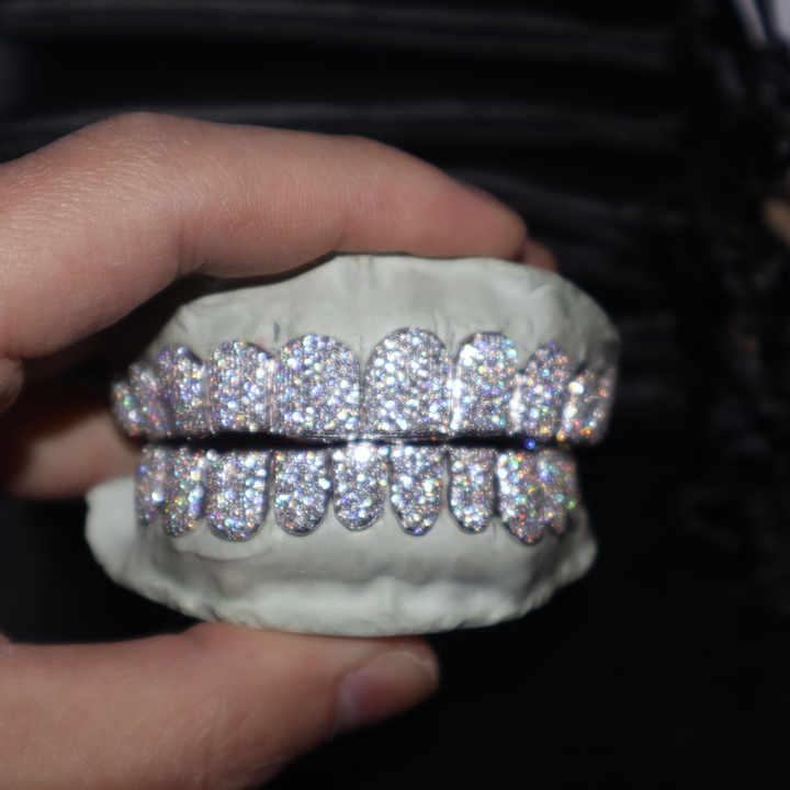 Custom Diamond Grills - Iced Out Your Own Dental Jewelry
