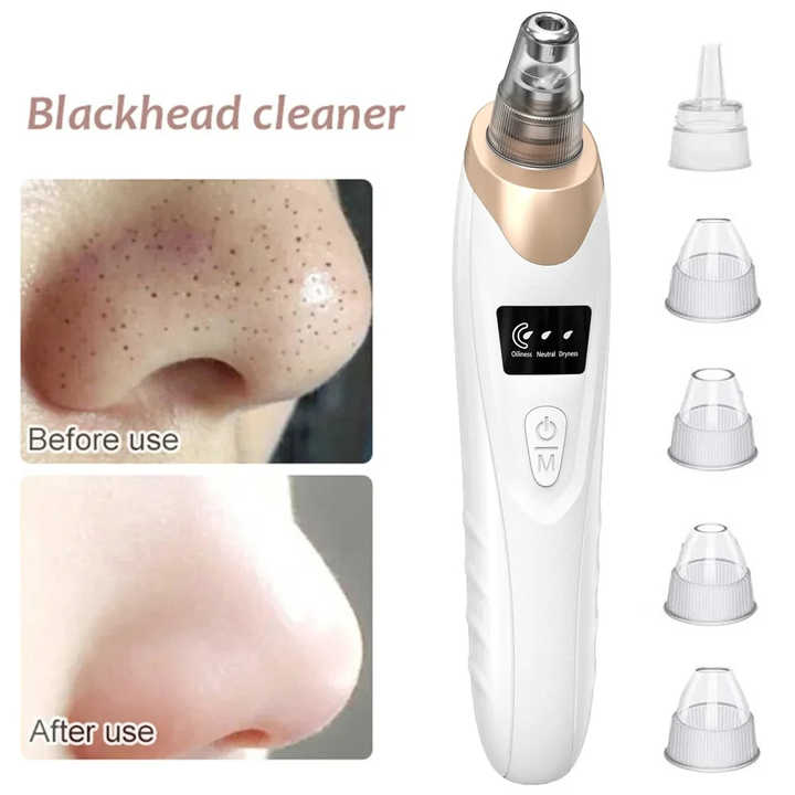 Ultrasonic Electric Facial Deep Pore Cleaning Acne Remover Vacuum ...
