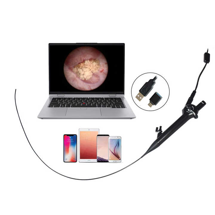 Disposable Endoscope - Single Use Flexible Video Ureteroscope with CE