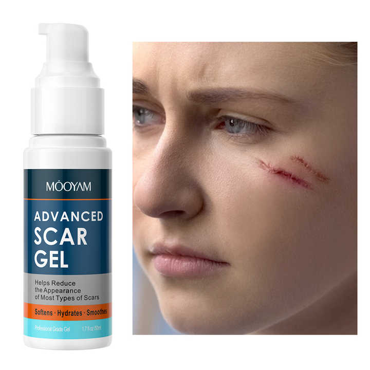 Private Label MOOYAM Removal Scar Gel - Fastest Scar Repair