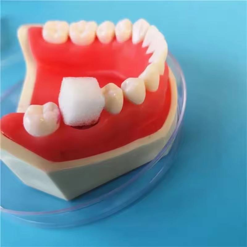 Medical Absorbable Hemostatic Sponges Wound Hemostasis in Tooth ...