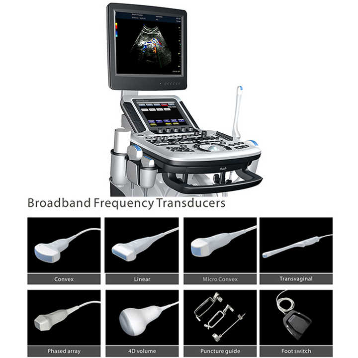 MSL 4D Ultrasound Scanner - Portable & Versatile Diagnostics