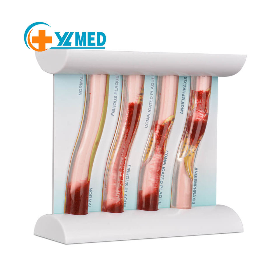 Dynamic Change Blood Vessel Model with Simulated Blood Flow for ...
