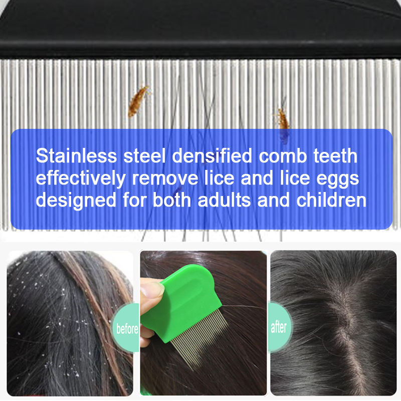 Durable Plastic Handle with Metal Pins for Removing Nits and Lice ...