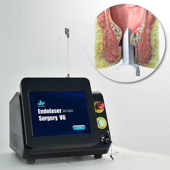 Minimally Invasive Proctology 1470nm 980nm 47W Laser Treatment Hemorrhoids Anal Fistula Surgery ...