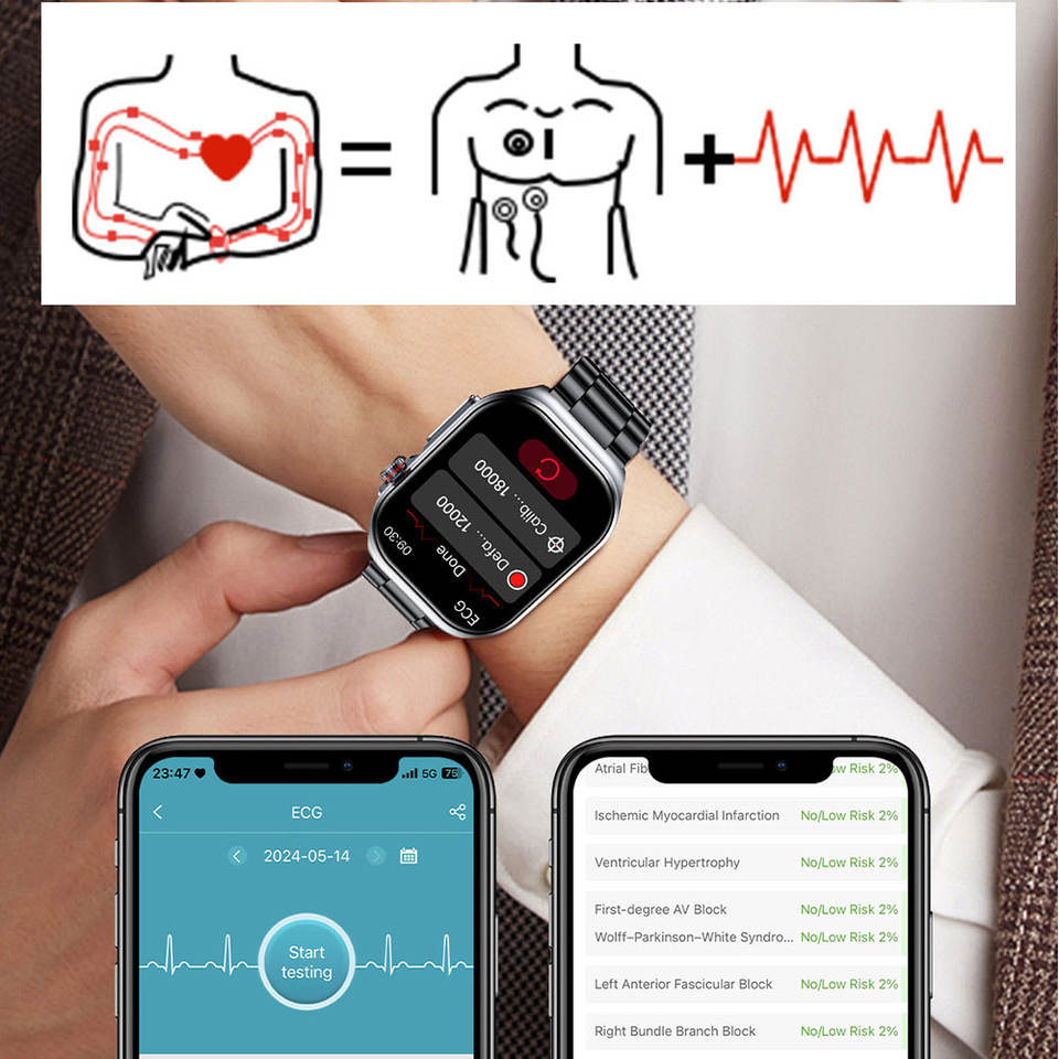 Spovan AMOLED Waterproof Smartwatch Blood Pressure Oxygen Monitor Sleep ...