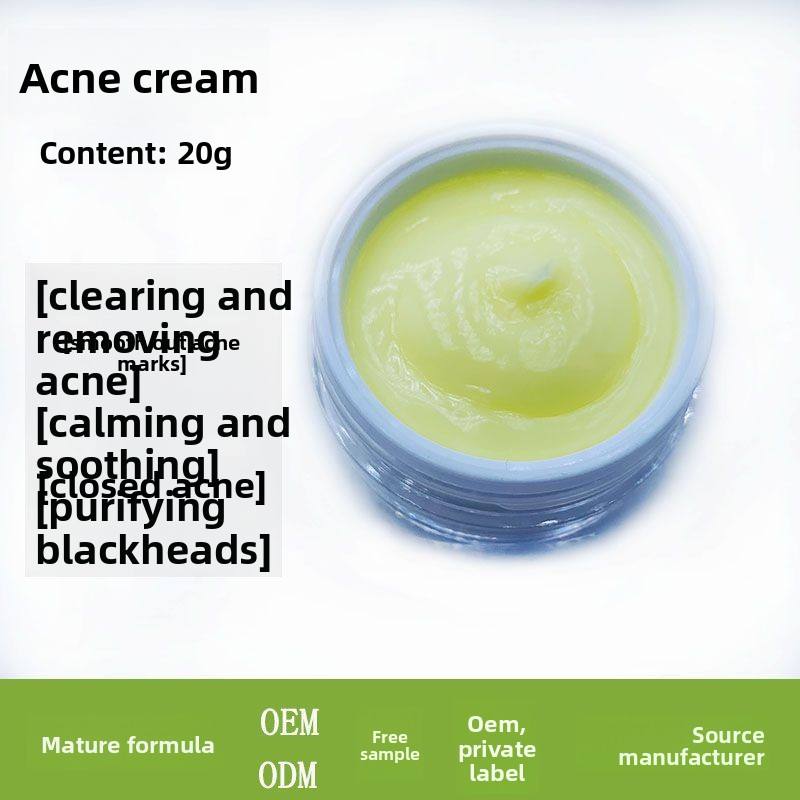 Acne Cream Powerful Remove Acne Dissolve Marks Pits Scars Herbal ...