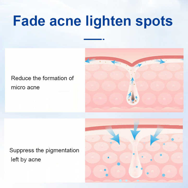 180 Tablets/Box Invisible Overnight Spot Treatment for Acne Solid Form ...