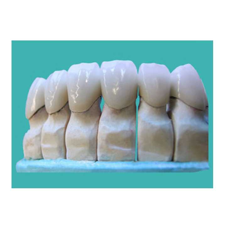 Durable Dental Teeth Prosthetics - Porcelain Fused to Metal Co-cr