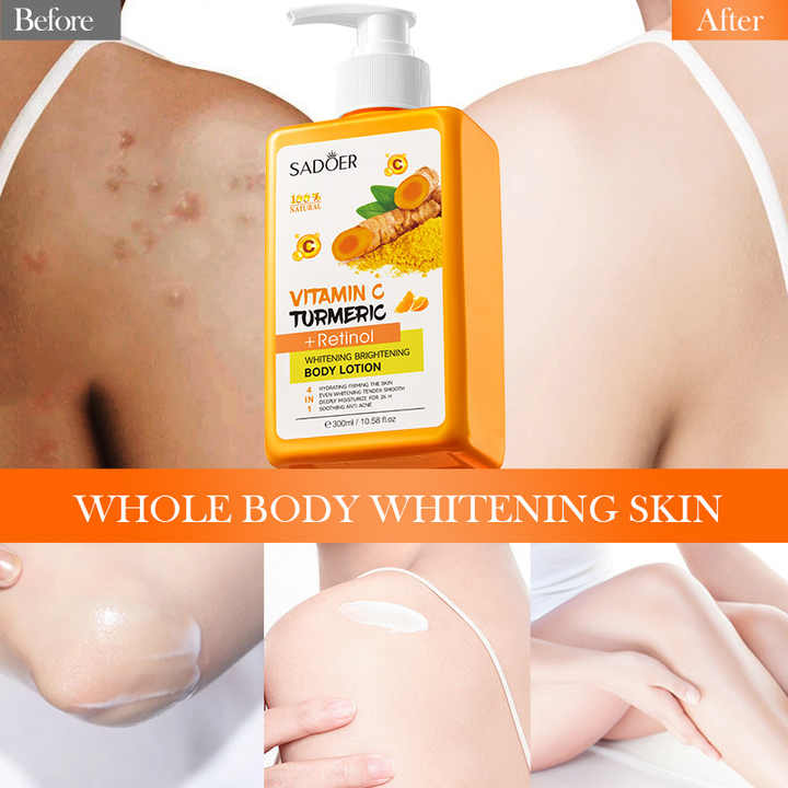 SADOER Vitamin C Turmeric&Retinol Whitening and Brightening Body Lotion| Alibaba.com