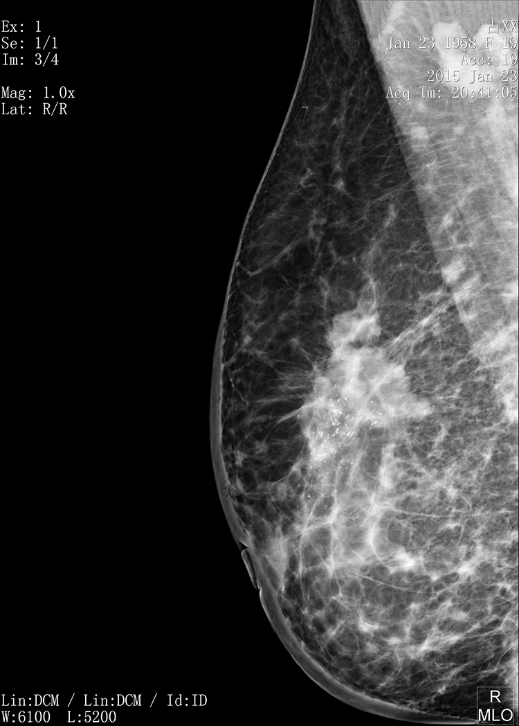 Mamografi Üreticileri - Güvenilir Bilim ve Cerrahi Çözümler