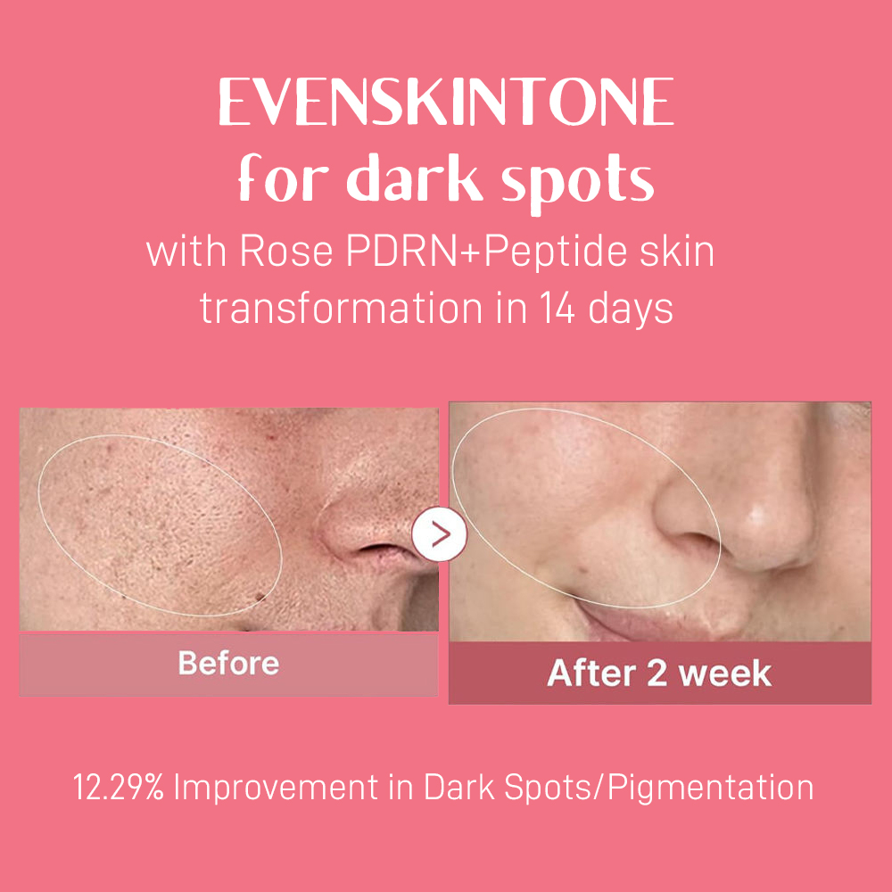 Transform Your Skin with Premium niacinamide toner private label for ...