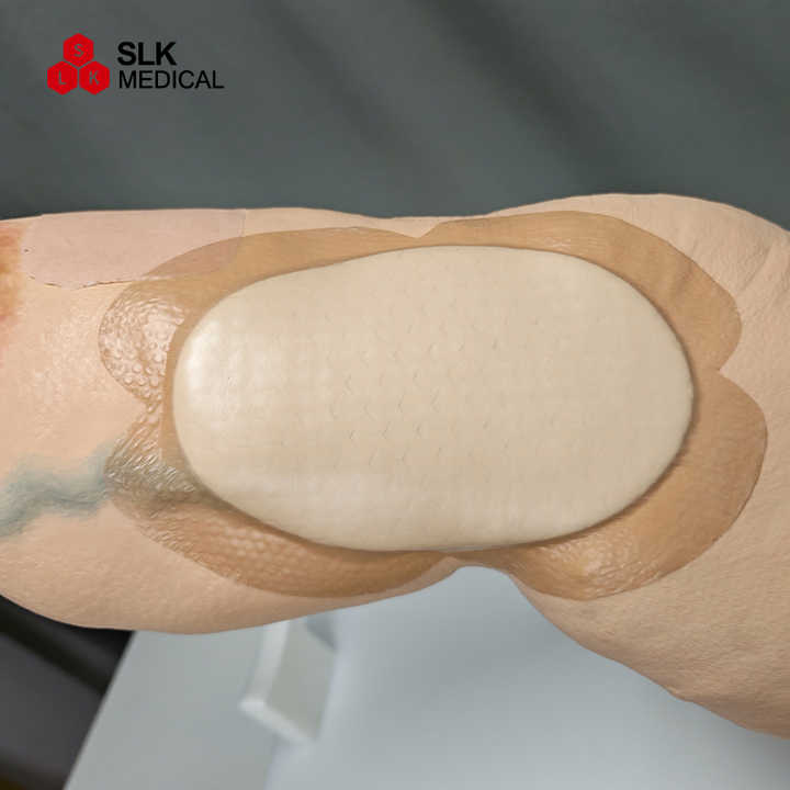 Alexer Silicone Foam Dressing Border Flex Silicone Gel Pain-free ...