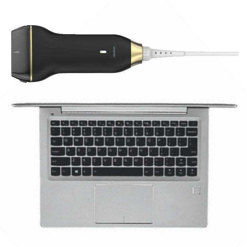 Medical Electric Handheld Ultrasound with Linear Probe for Vascular ...