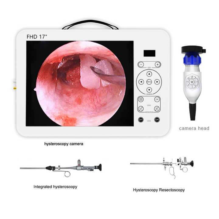 17 Inch Portable Full hd Medical Hysteroscope ENT Endoscopy Camera ...