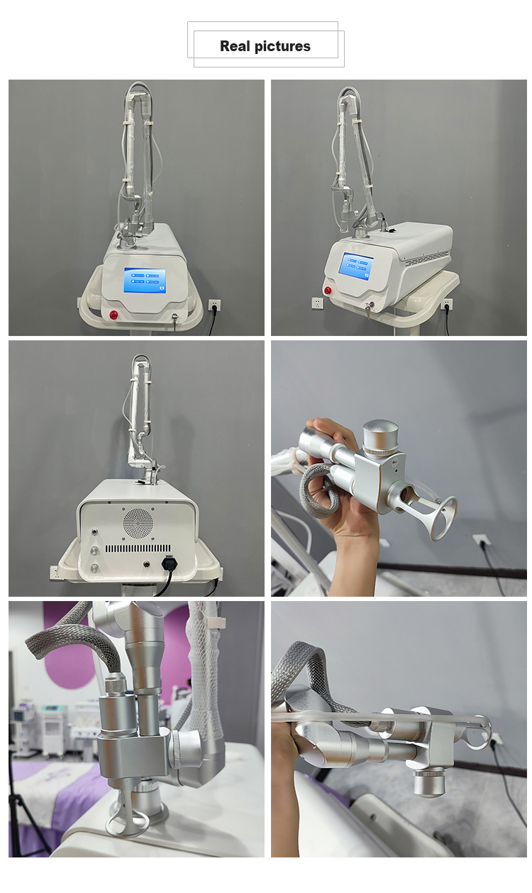 CO2 Laser Resurfacing Machine: Professional Fractional Laser For Scar, Acne, Wrinkle Removal ...