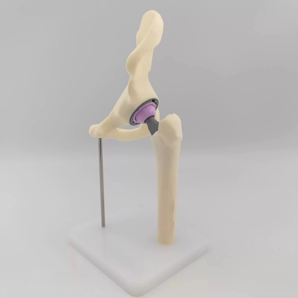 KyrenMed Mini Hip Replacement Model Hip Implant Model Orthopedic ...