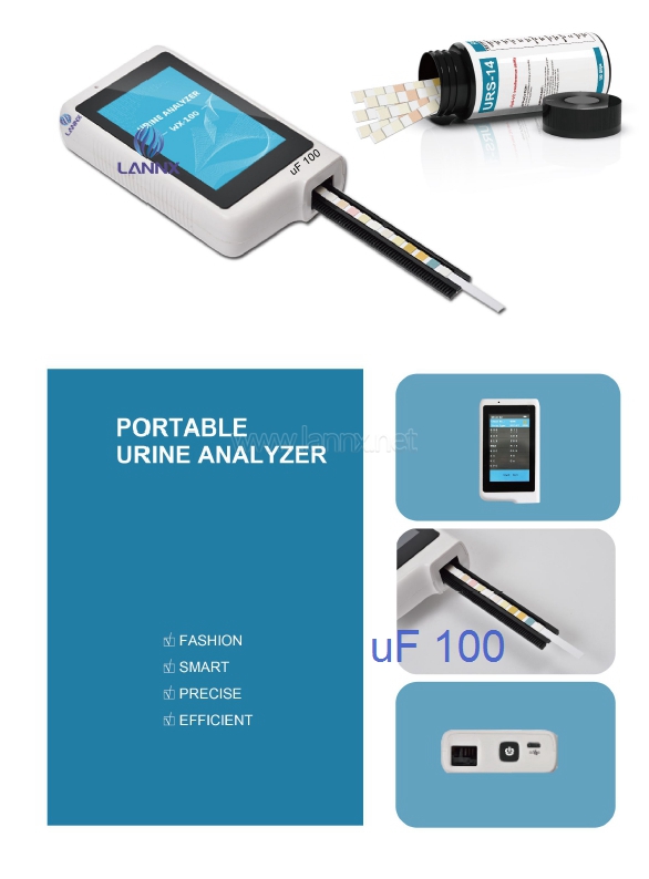 Precision & Reliability with Advanced automated urinalysis analyzer ...