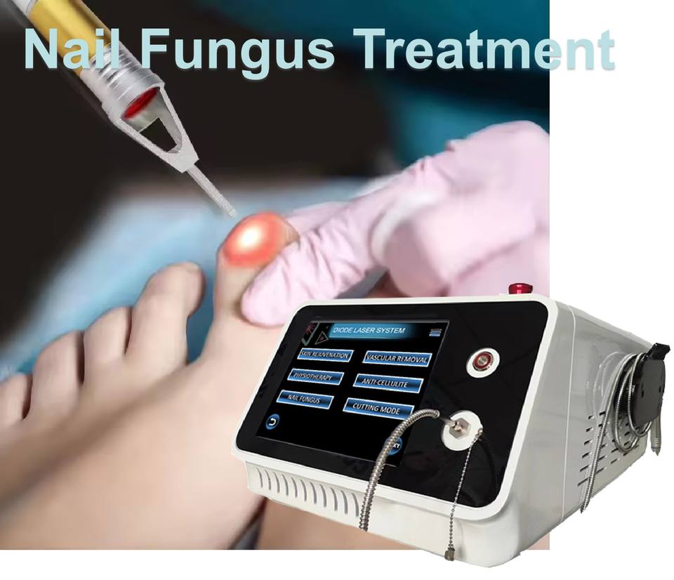 2026 PodoLaser Toenail Fungus 980nm Onychomycosis Podiatry ...