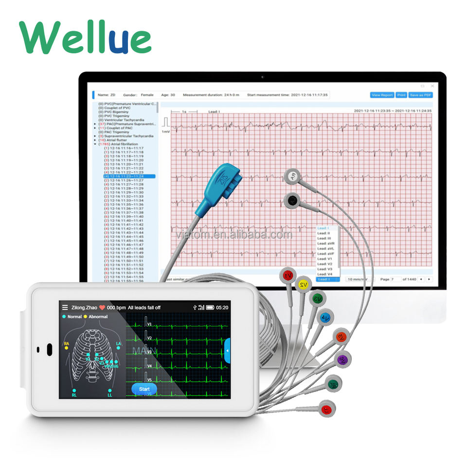 Wellue PCECG 500 Portable Ecg Machine 12 Leads Ecg Holter Recorder ...