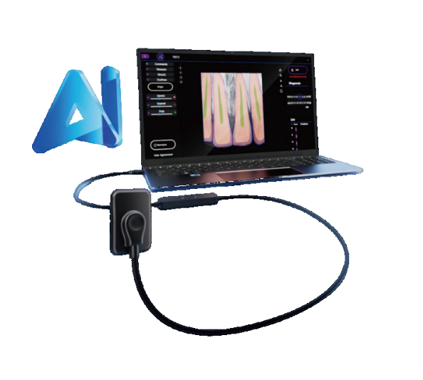 Dental Intraoral Imaging X Ray System With AI Sensor / Digital X-Ray ...