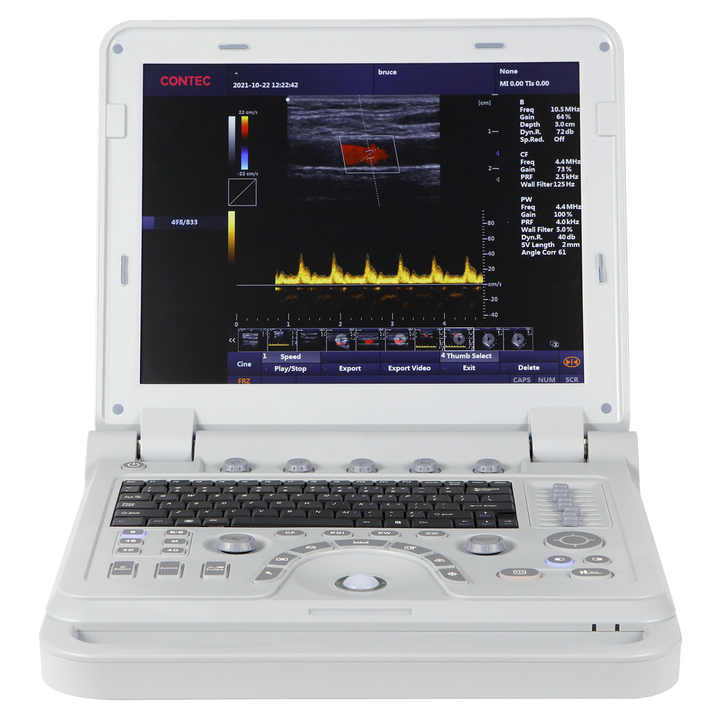 CONTEC CMS1700A Colour Doppler Cardiac Ultrasound Scanner