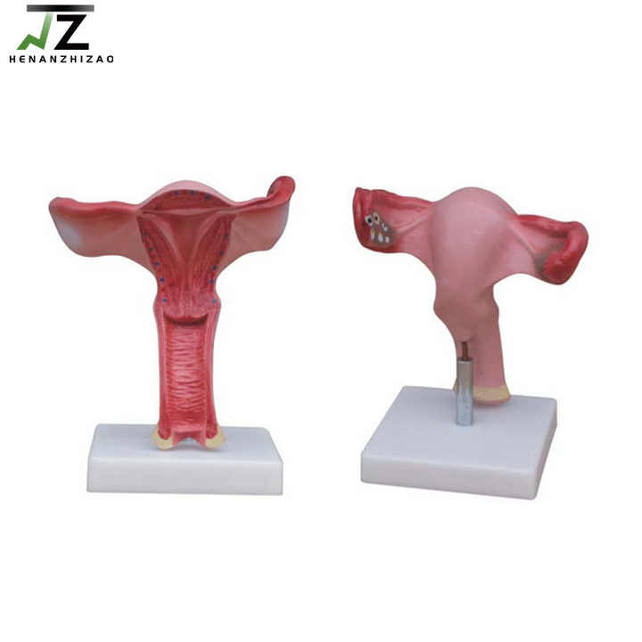 Medical Science Magnified Human Anatomical Uterus Model for Human ...