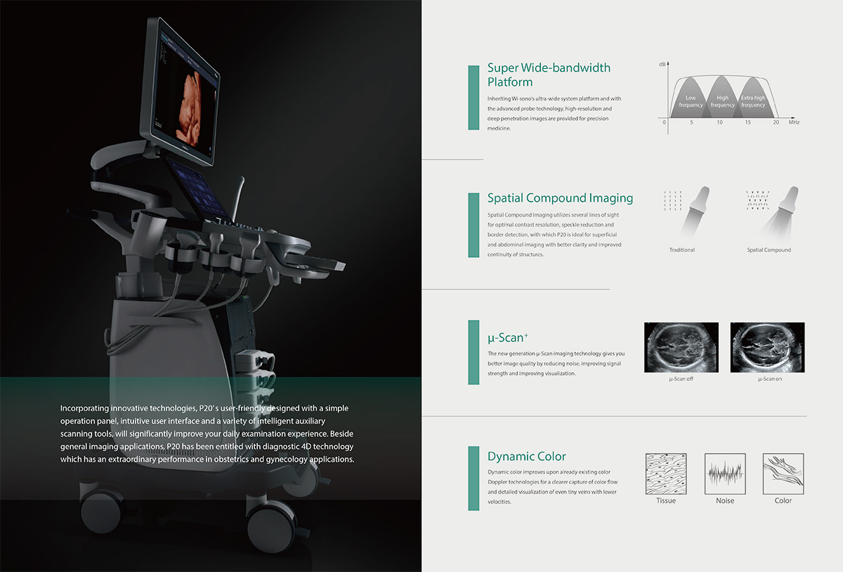 Sonoscape P20 3D |4D | 5D Ultrasound Color Doppler