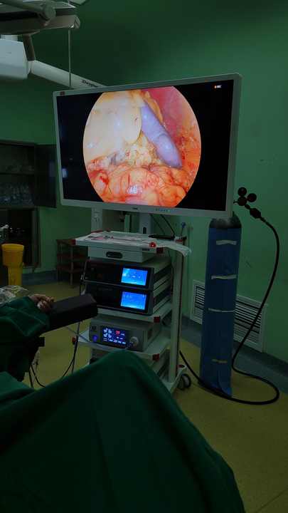 Laparoscopy 3D 4K Medical Endoscopic Camera System - Advanced ...