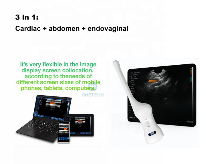 B26D 192E 3in1 Portable Ginecologia Transvaginal and Abdominal Probe ...