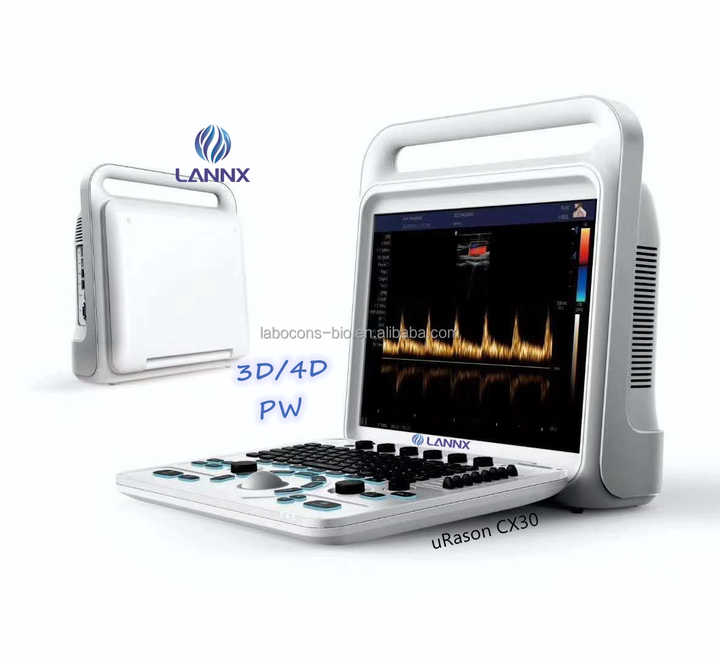 LANNX URason CX30 New Design Digital Color Doppler Ultrasound Scanner Ecografo System 3D/4D ...