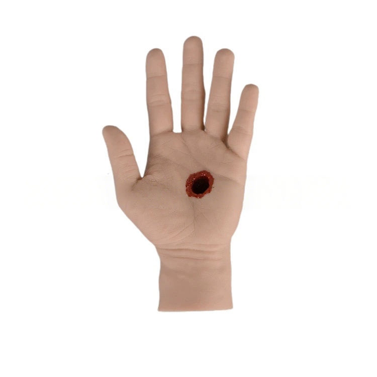 Hand Trauma Penetrating Wound Bandage Nursing Model Hand Palm ...
