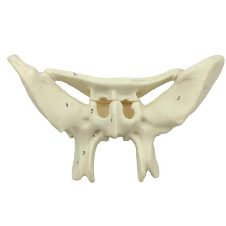 Sphenoid Enlargement Model Human Sphenoid Model Sphenoid Enlargement 3 ...