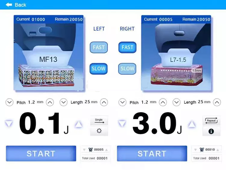 New Technology Hi Fu For Face Lift And Lipo Body Sonic Slimming Machine ...