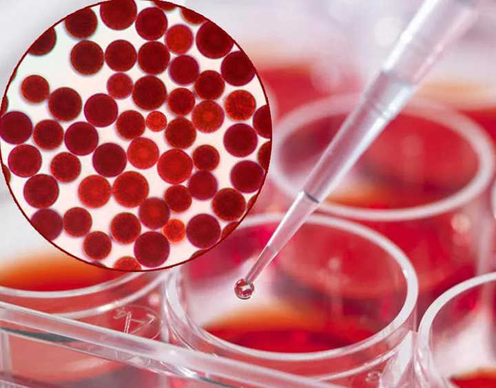 High Quality Natural Red Algae Haematococcus Pluvialis Extract 10% ...