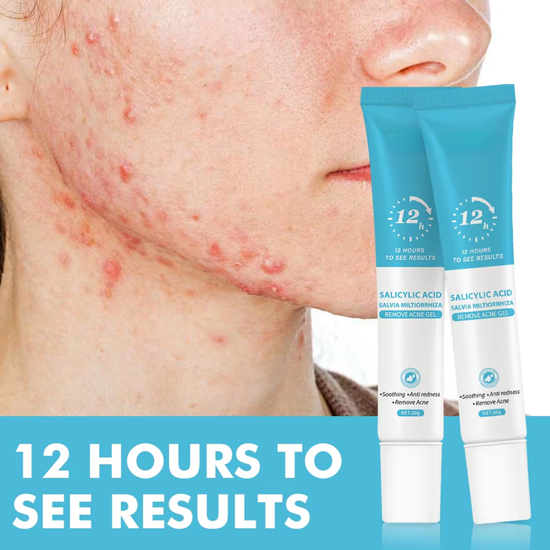 Wholesale Salicylic Acid Acne Treatment Gel, Fast Acne Clearing and ...