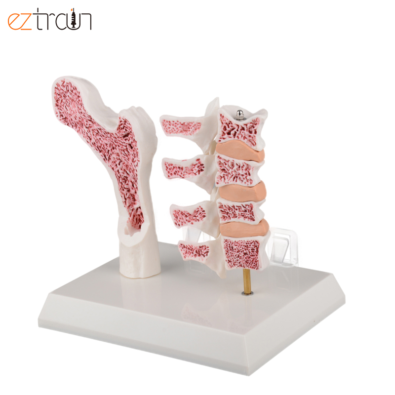 How to Choose the Best Orthopedic Model for Medical Training & Education