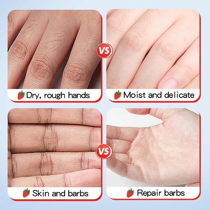 SADOER Natural Vitamin E Nourish Brighten Hands Repair Strawberry ...