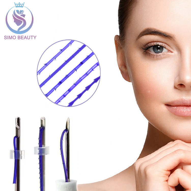 Aesthetic lift absorbable 3d plastic facial pdo barbed thread lift for ...