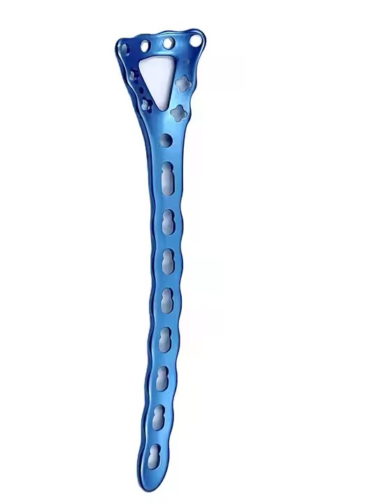 How to Choose the Right Proxima Tibial Plate: A Complete Buying Guide