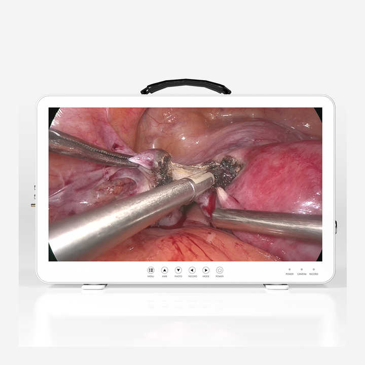 27 Inch FHD 1080P Portable Laparoscope Endoscope Camera for ...