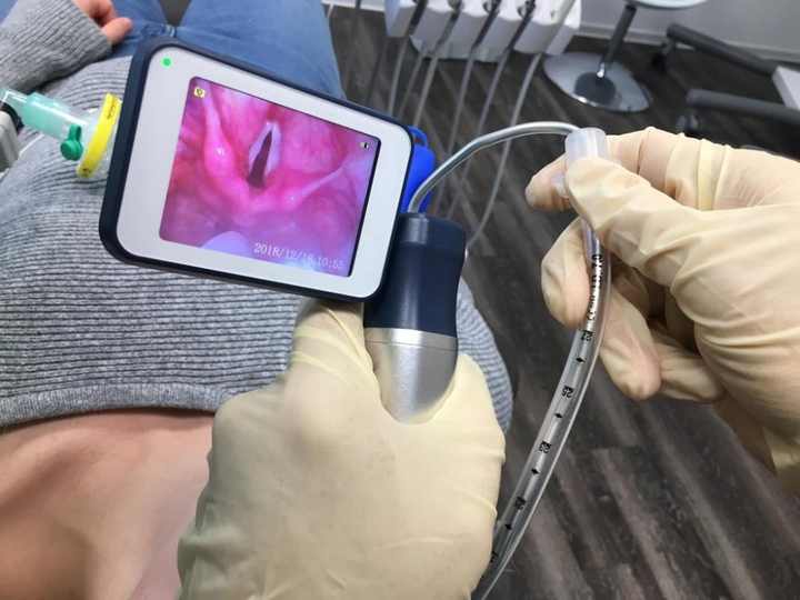 Operating Room Video Laryngoscopy - BESDATA Laryngoscope