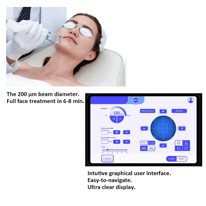 1550nm & 1927nm Thulium Laser Machine for Skin Resurfacing