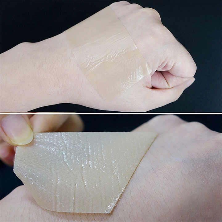 Hysent Skin Color Medical Scar Sheet Silicone Gel Scar Paste Silicone ...