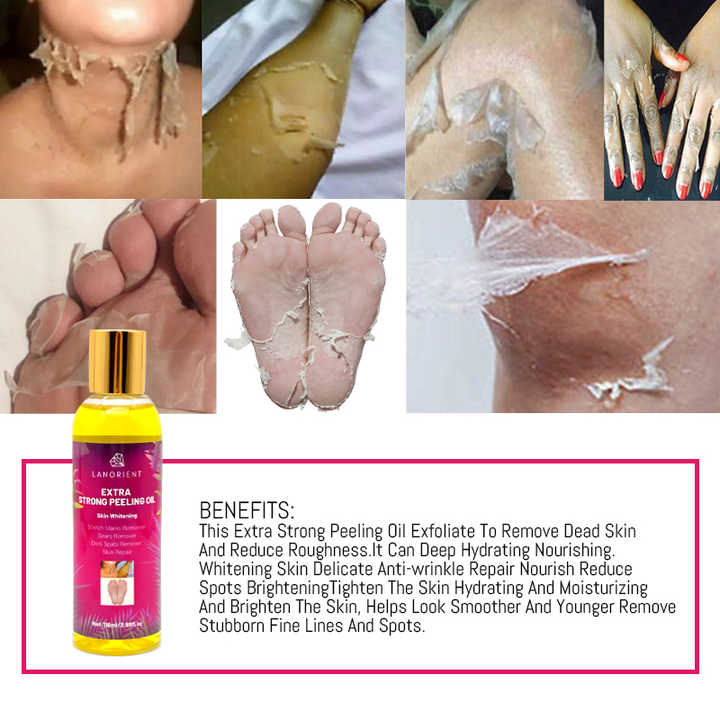Lanorient Yellow Peeling Oil - Extra Strong Skin Whitening
